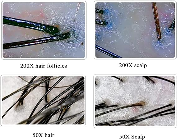 Capilógrafo de 10 pulgadas – TecnoEsteticos.com